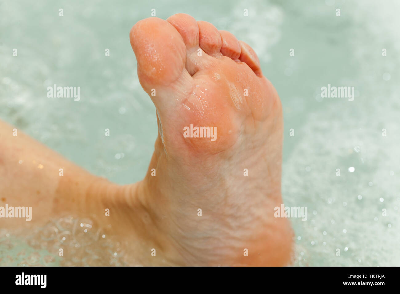 Body swelled hi-res stock photography and images - Alamy