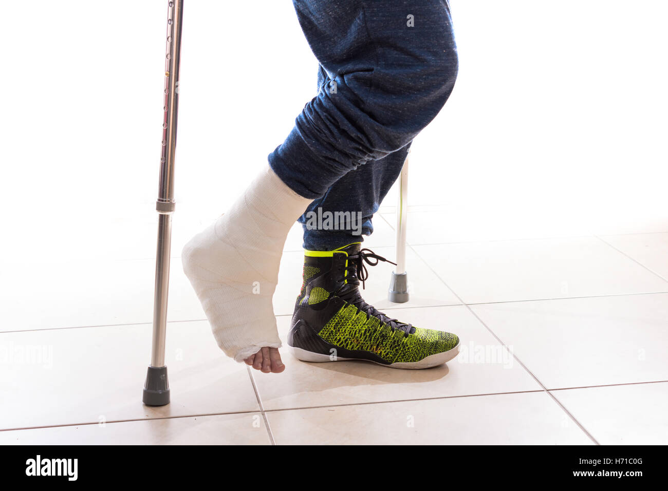 Fiberglass cast on broken ankle hi-res stock photography and images - Alamy