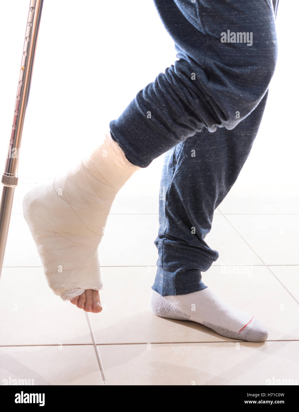 Young man with a broken ankle and a white cast on his leg, walking on ...