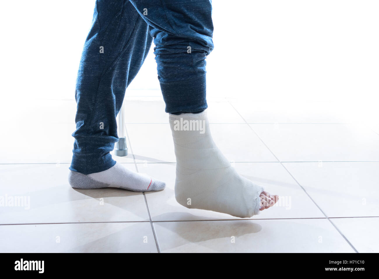 Young man with a broken ankle and a white cast on his leg, walking on ...