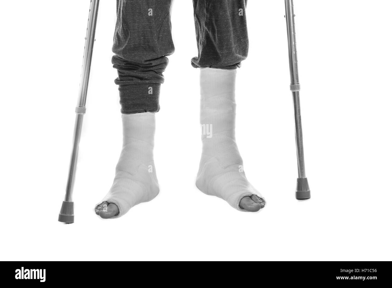 Young man with two broken ankles and dual white casts on his legs ...