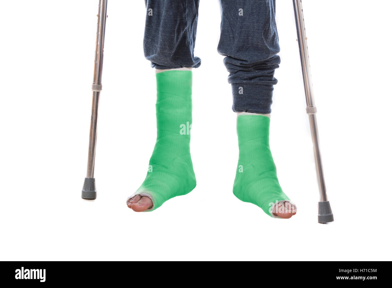 Young man with two broken ankles and dual green casts on his legs ...