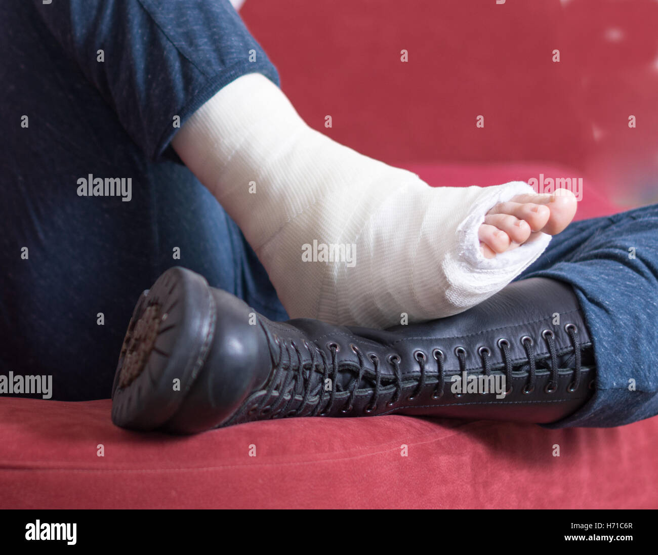 Broken Leg Cast Boot