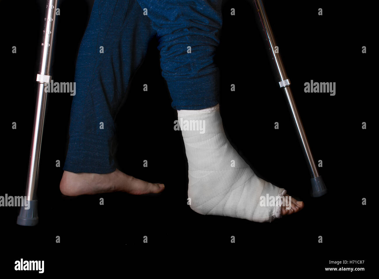 Young man with a broken ankle and a white cast on his leg, walking on ...