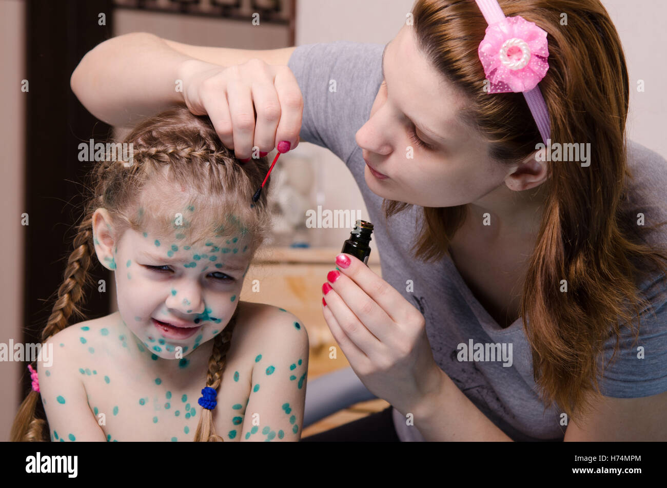 Stick rash hi-res stock photography and images - Alamy
