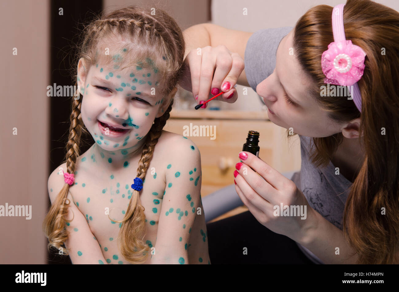 face skin small tiny little short dots grease besmear lubricate mother ...