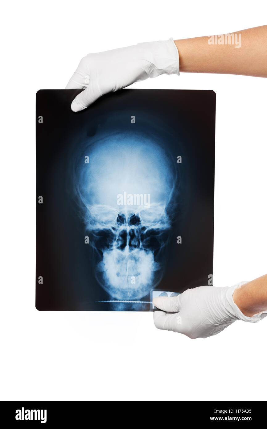 Doctor nurse xray in hi-res stock photography and images - Alamy