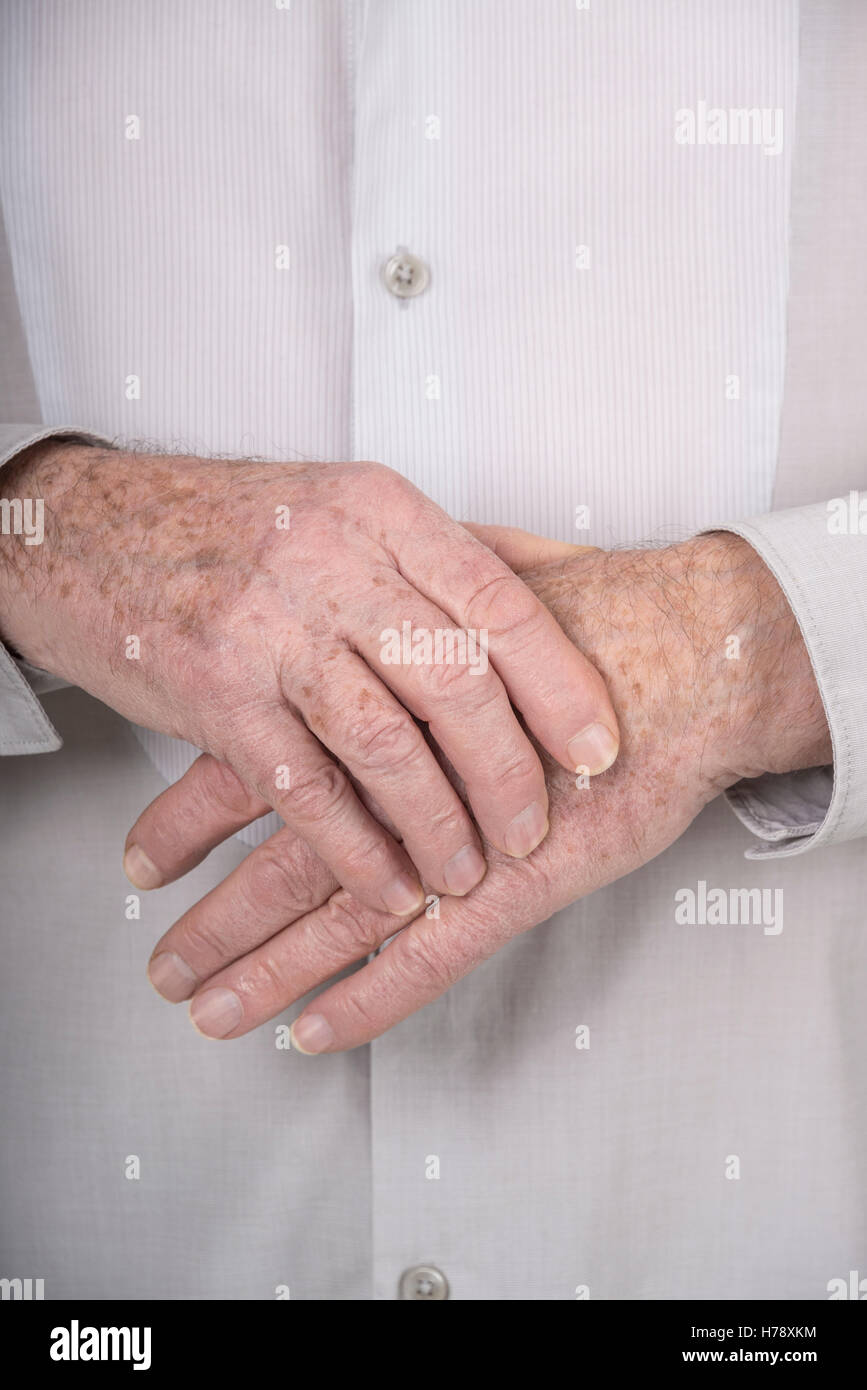 SENIOR WITH PAINFUL HAND Stock Photo - Alamy