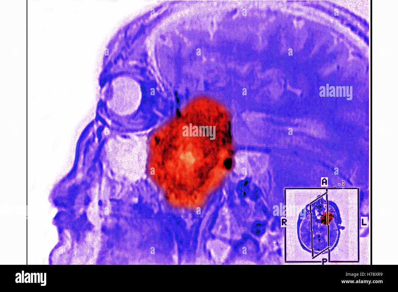 Cranial nerve examination hi-res stock photography and images - Alamy
