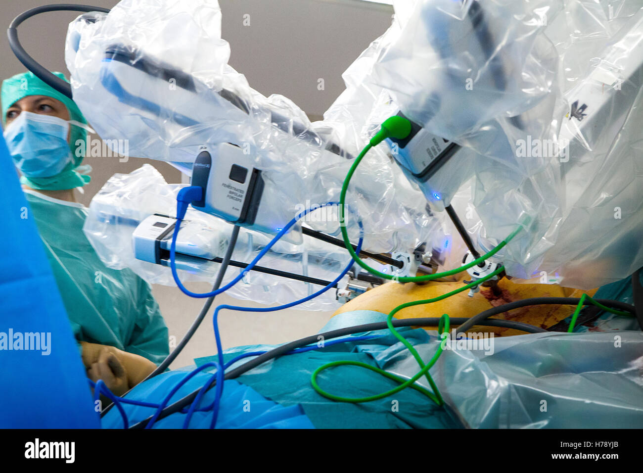 Keyhole minimally invasive surgery hi-res stock photography and images ...