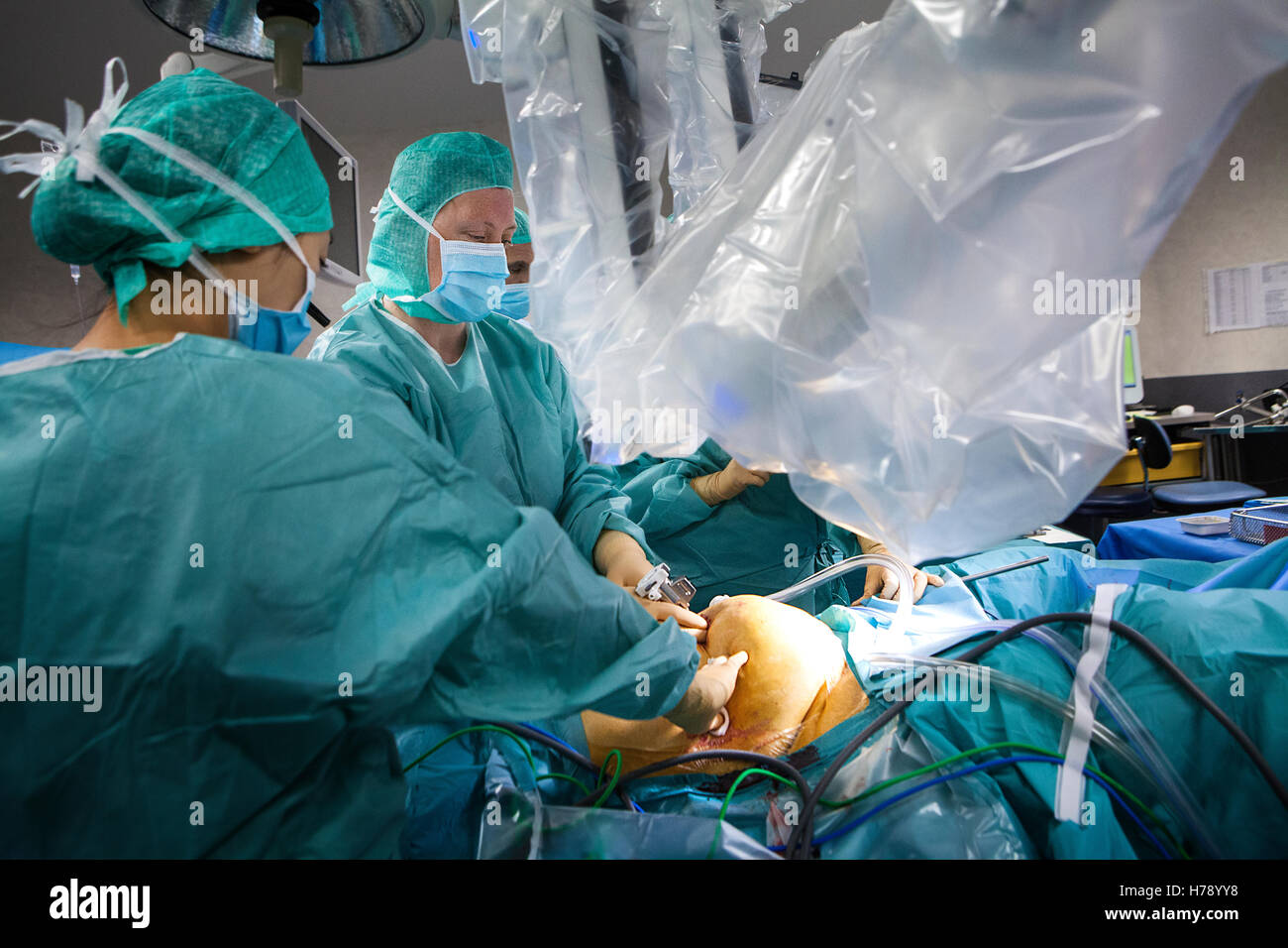 Laparoscopic hysterectomy hi-res stock photography and images - Alamy