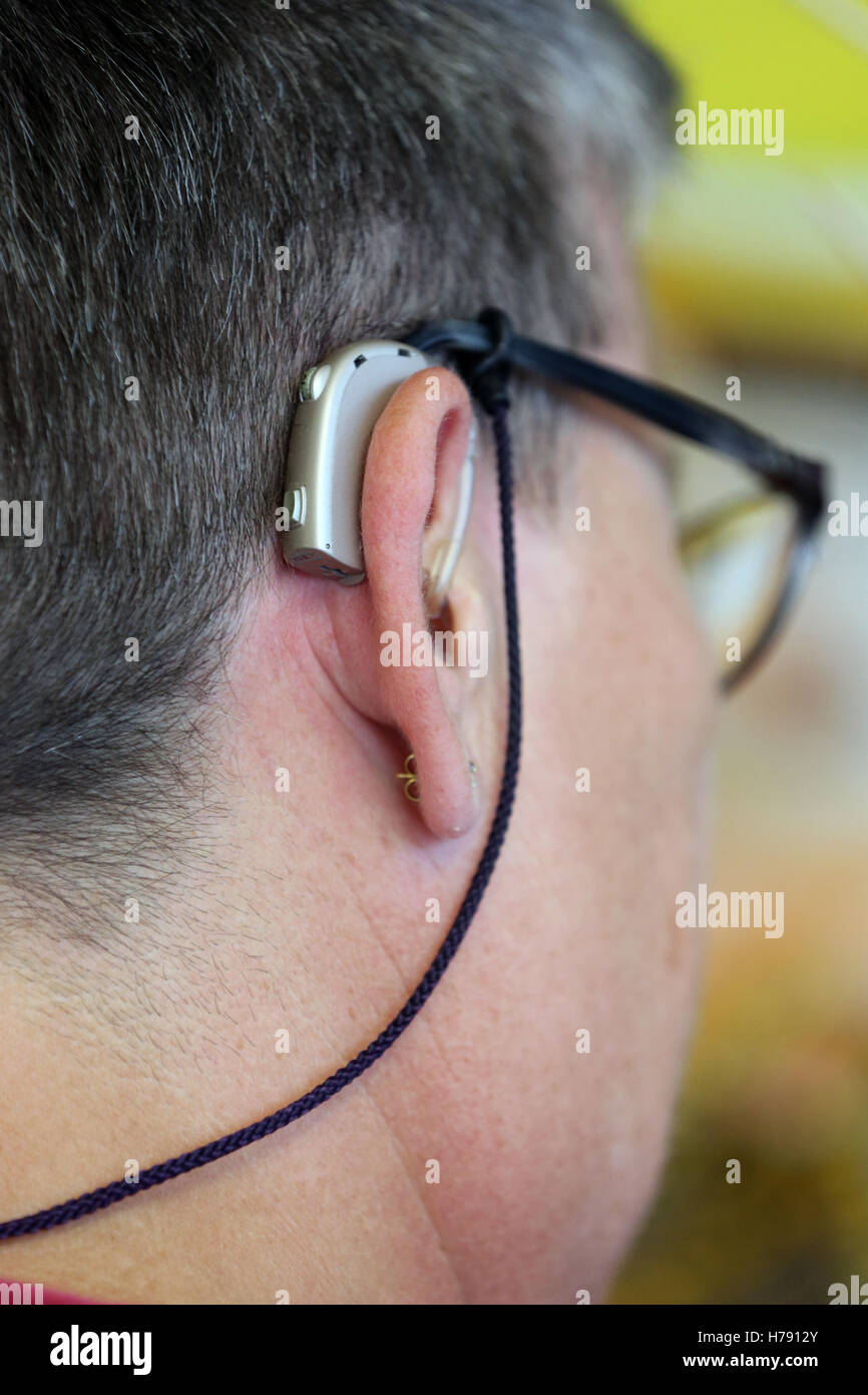 Acoustic prosthesis hi-res stock photography and images - Alamy