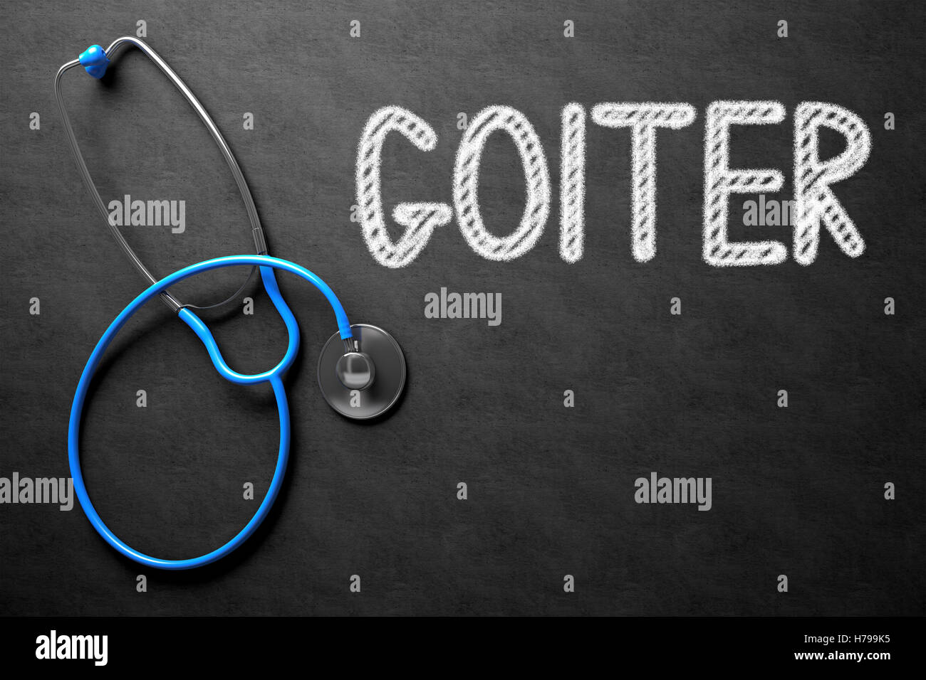 Goiter on Chalkboard. 3D Illustration Stock Photo - Alamy