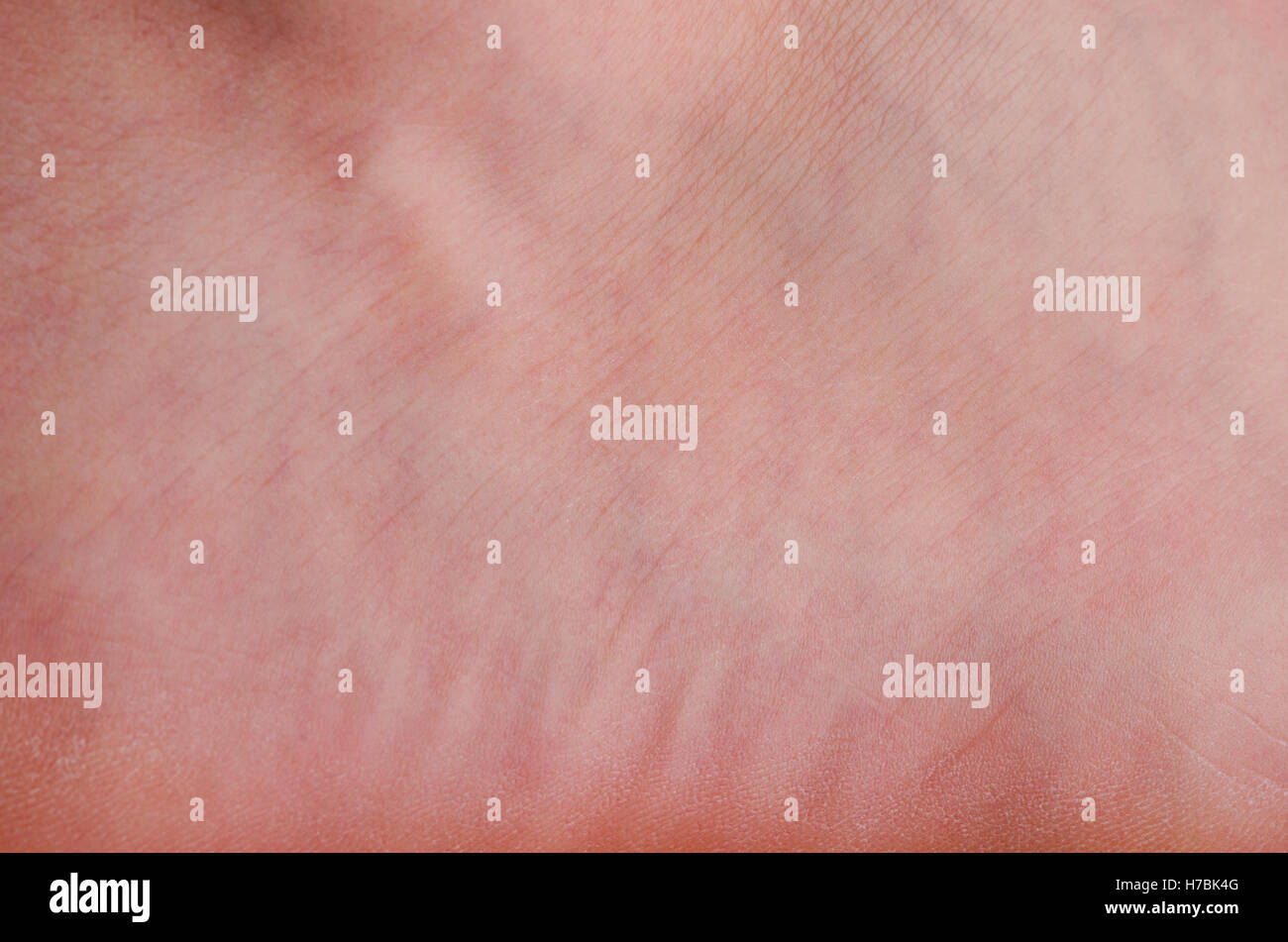 Human skin texture hi-res stock photography and images - Alamy