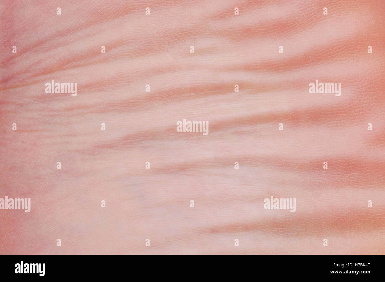 Cracked skin leg hi-res stock photography and images - Alamy