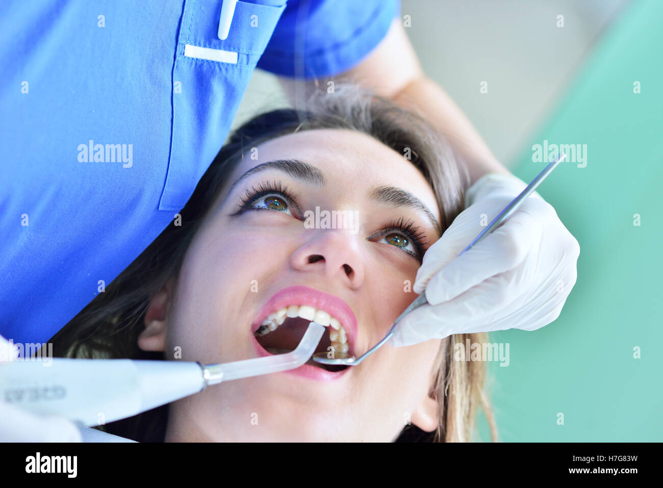 Close-up of female with open mouth during oral checkup at the dentist ...