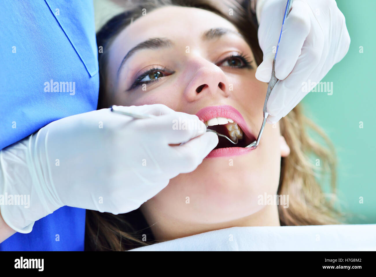 Close-up of female with open mouth during oral checkup at the dentist ...
