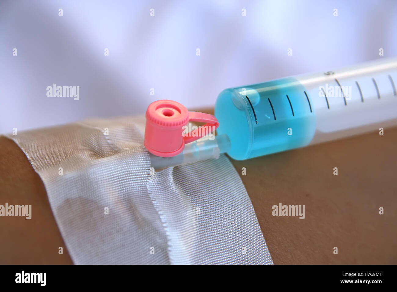 Intravenous infusion system. Intravenous medical therapy treatment ... Intravenous infusion system. Intravenous medical therapy treatment ...