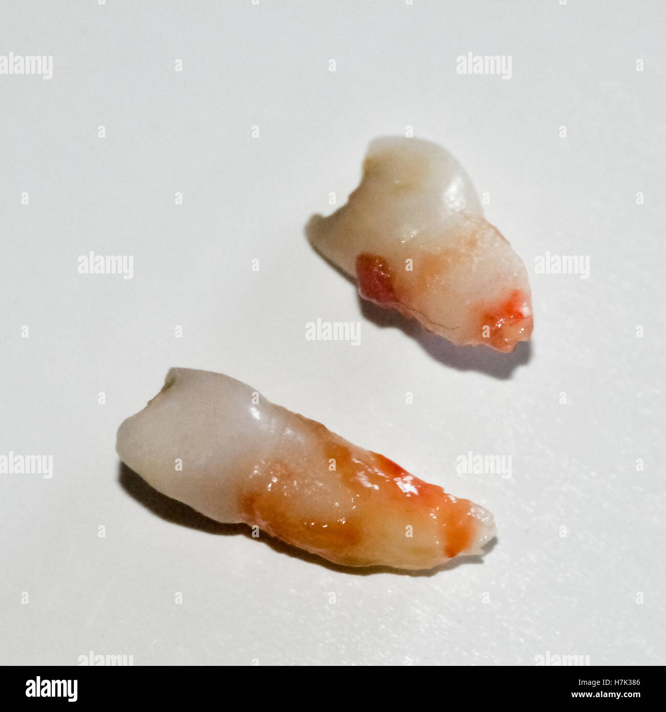 Primary teeth hi-res stock photography and images - Alamy