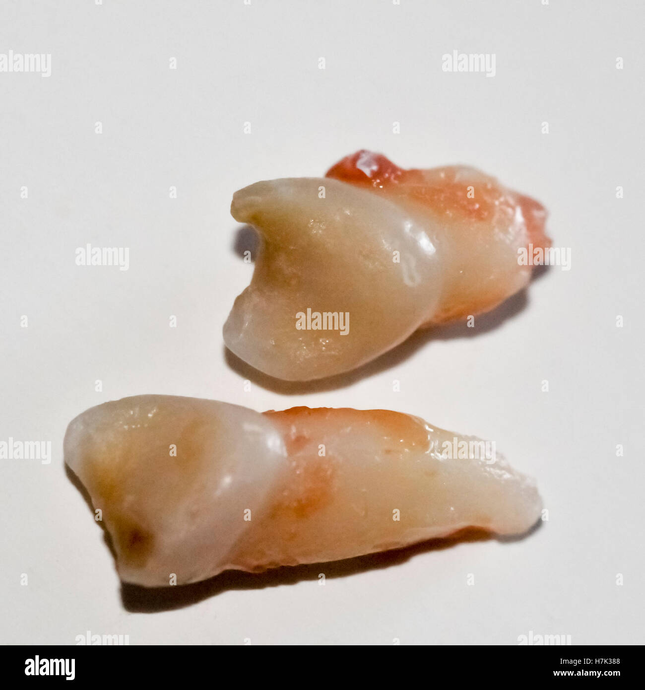 Primary teeth hi-res stock photography and images - Alamy