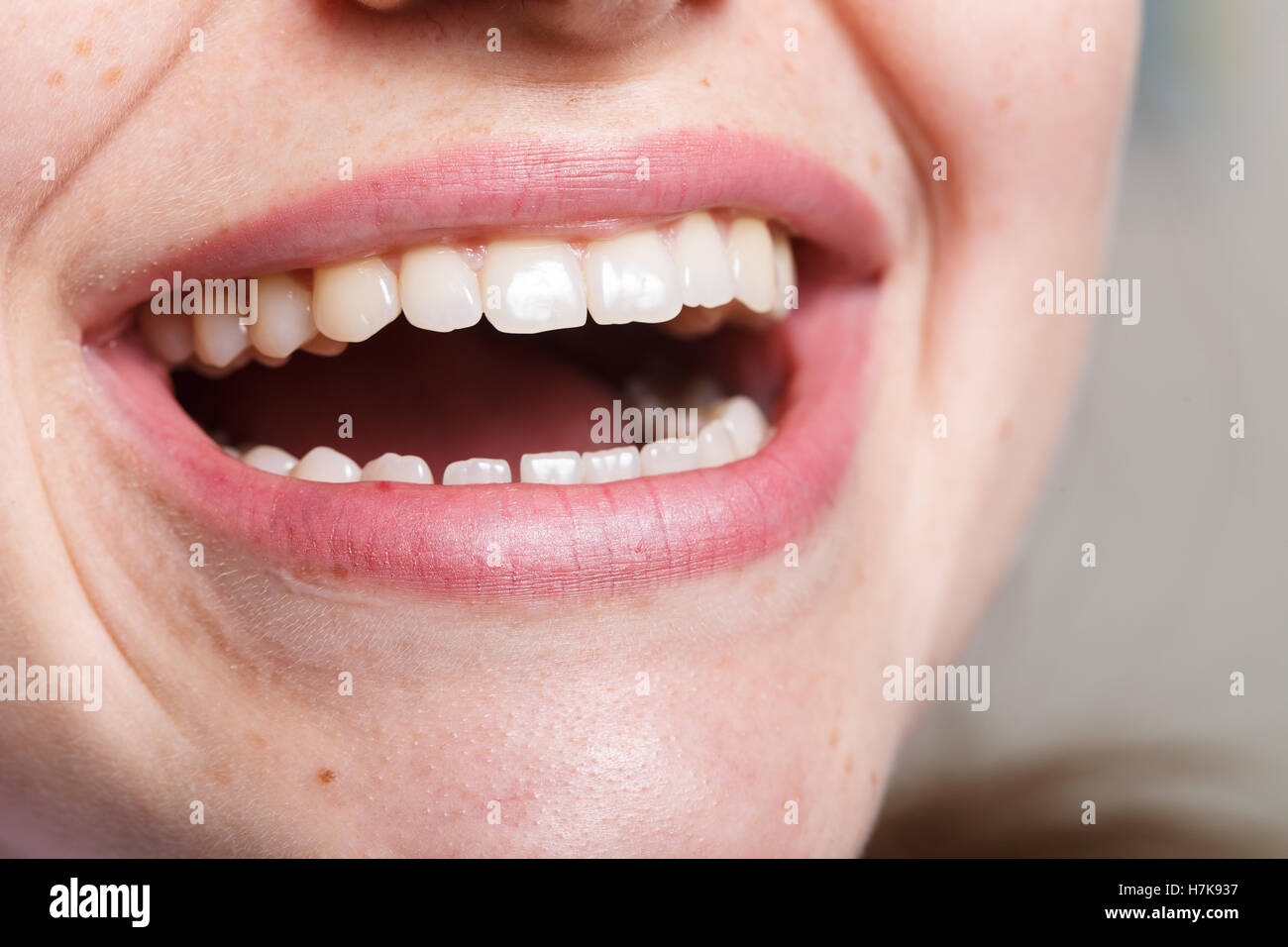 dentistry, mouth and teeth close up smiling Stock Photo - Alamy