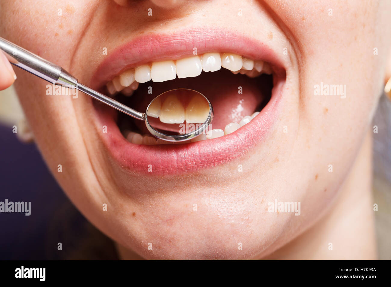 dentistry, mouth and teeth close up smiling Stock Photo - Alamy