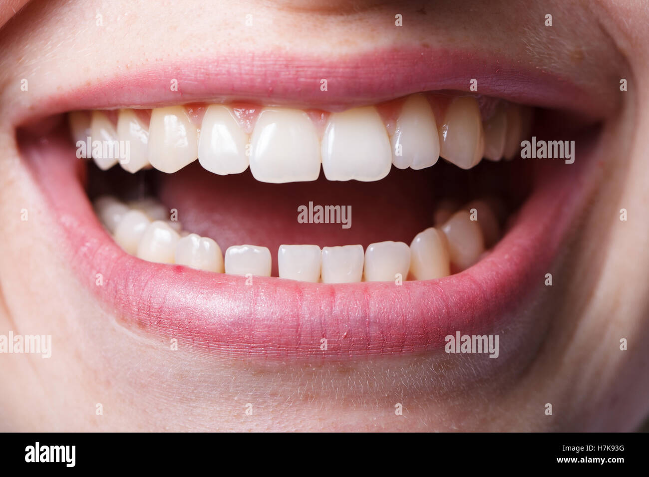 Woman mouth great teeth hi-res stock photography and images - Alamy