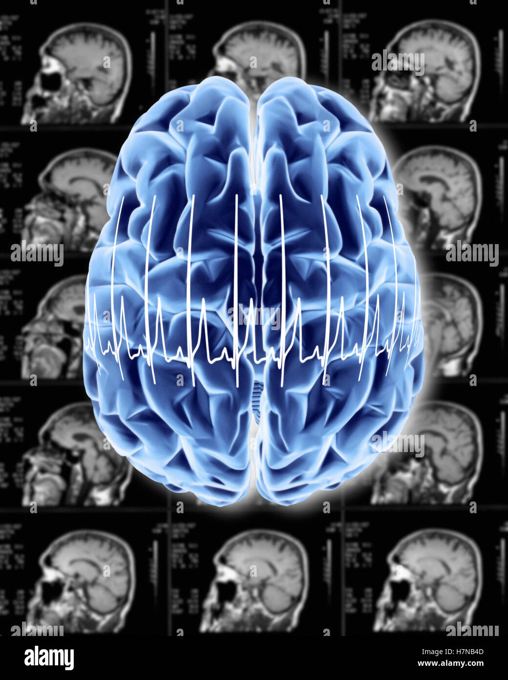 Cat brain anatomy hi-res stock photography and images - Alamy