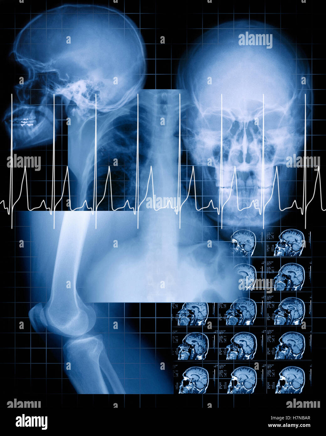 X-ray and MRI medical concept Stock Photo - Alamy