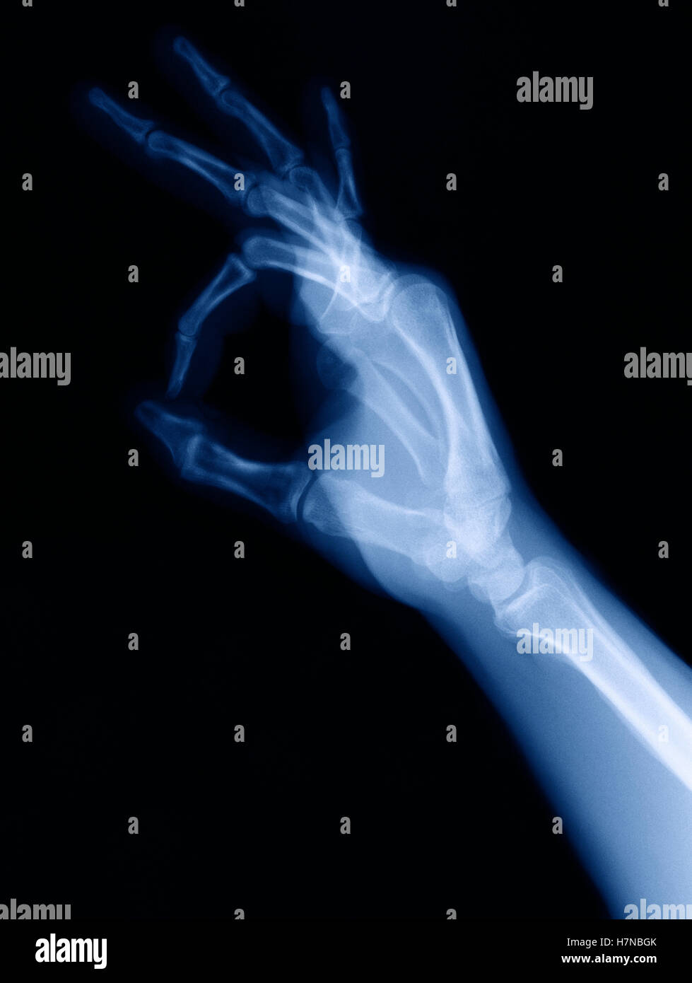 X ray human hand ok hi-res stock photography and images - Alamy