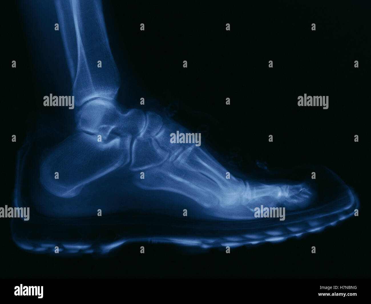X ray foot shoe hi-res stock photography and images - Alamy