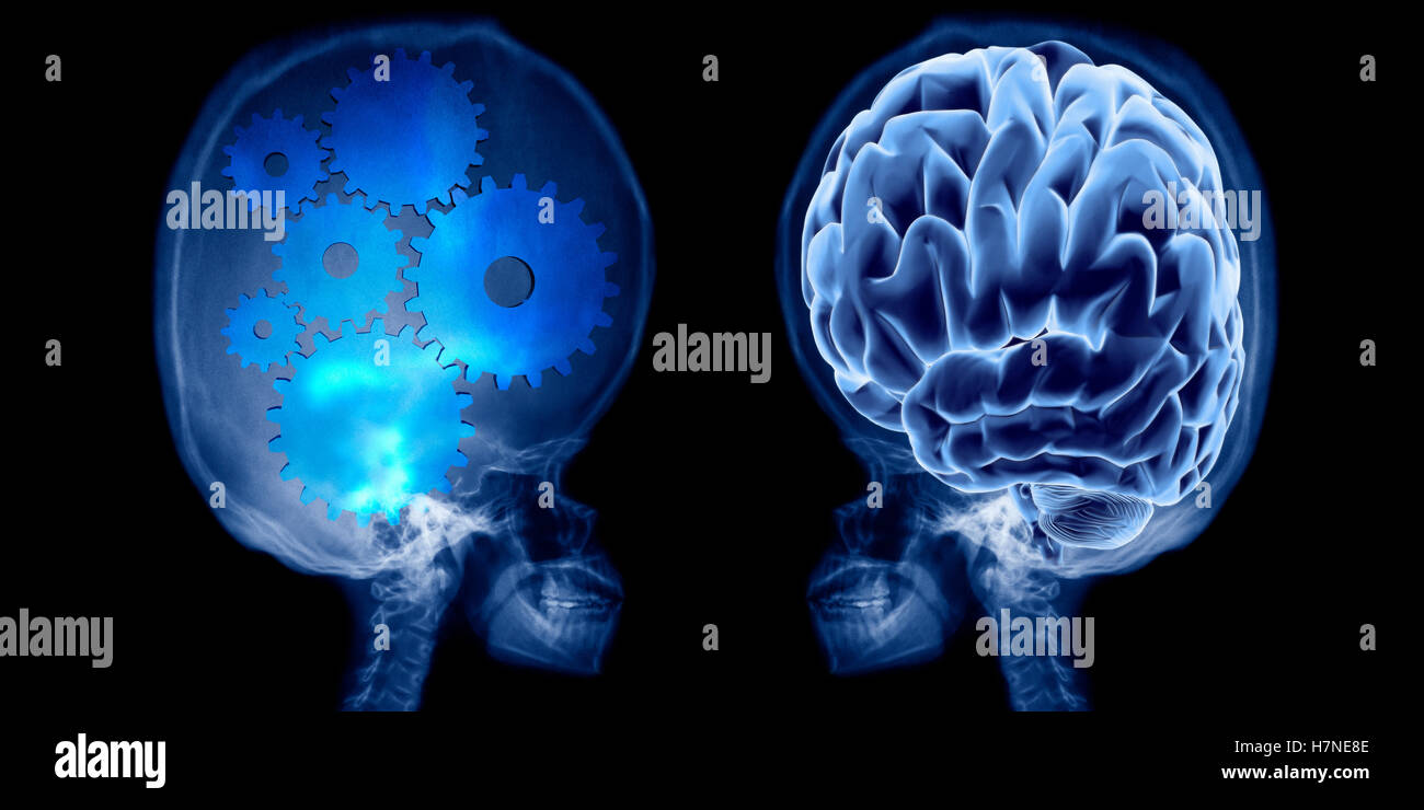 X-ray of inflated human skull with big brain Stock Photo - Alamy