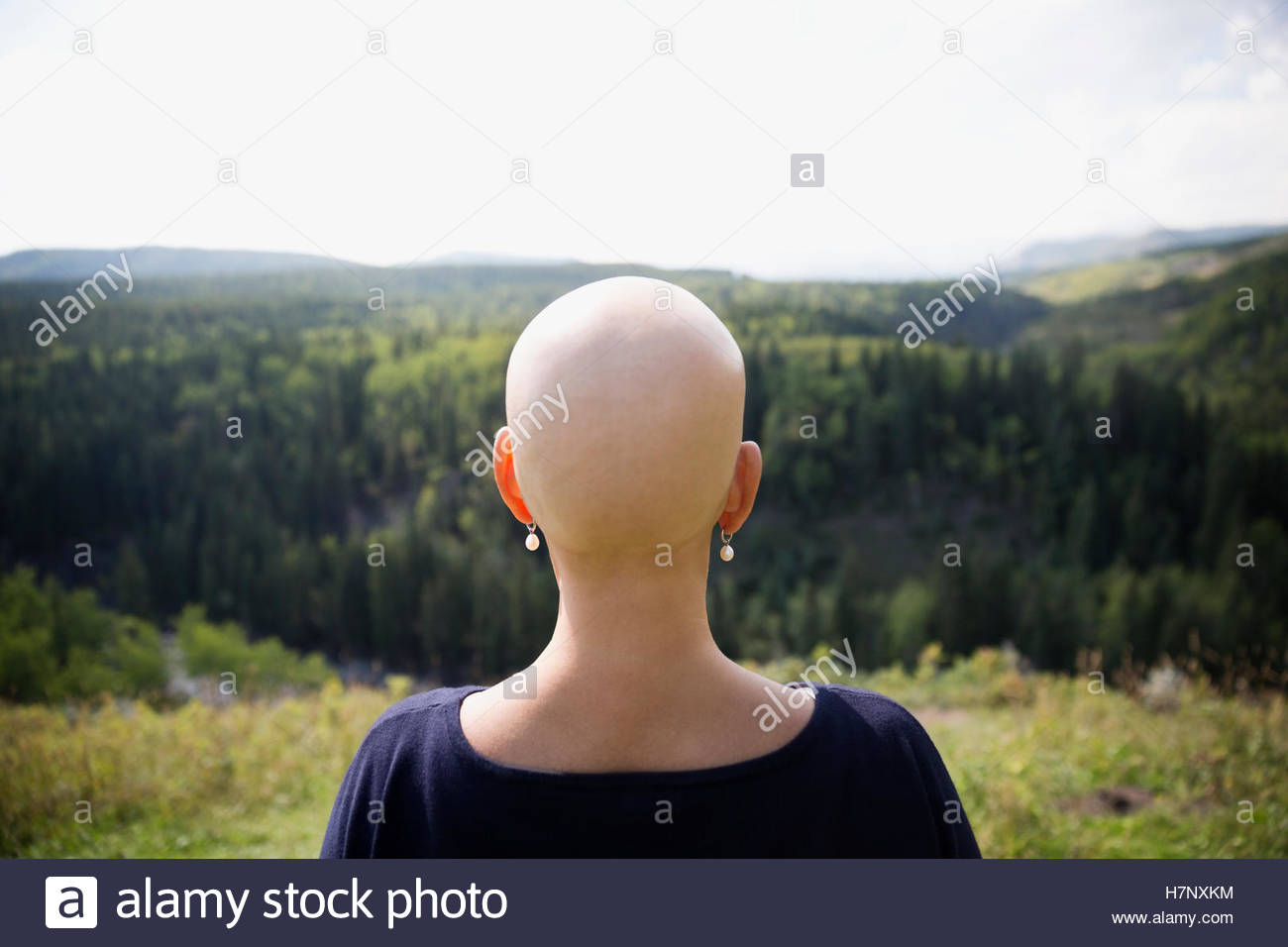 Female cancer survivor with shaved head looking at remote rural view ...