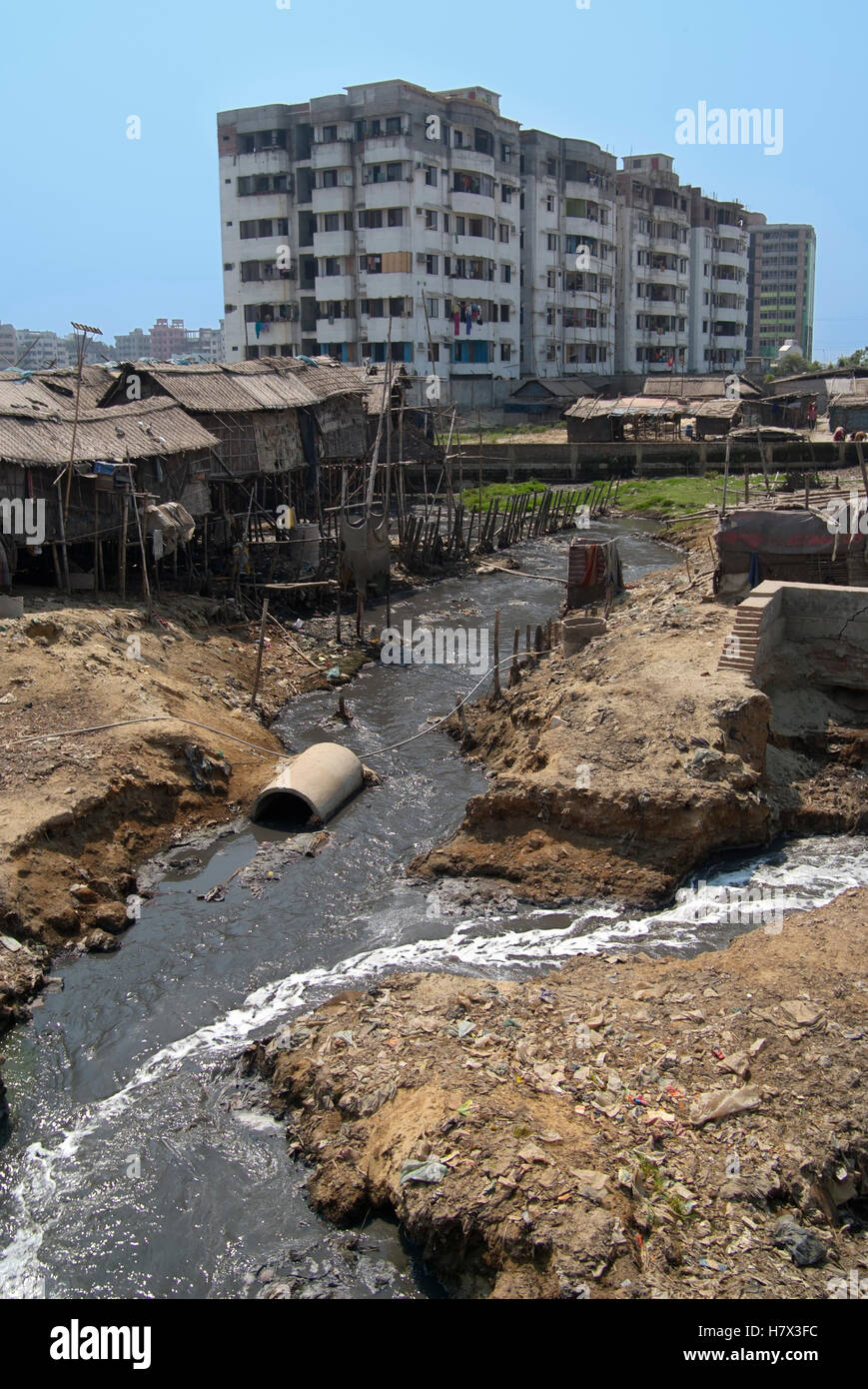 Sewage and shacks in Dhaka slum, Bangladesh Stock Photo - Alamy