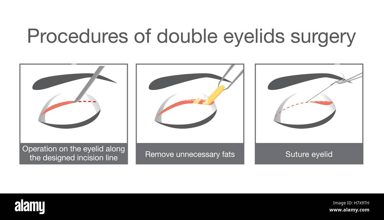 Double muscle Cut Out Stock Images & Pictures - Alamy