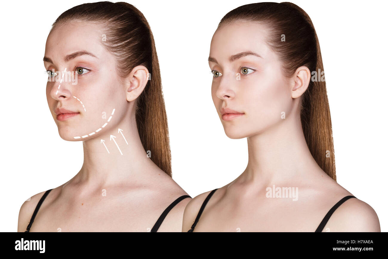 Young woman with arrows on face Stock Photo - Alamy