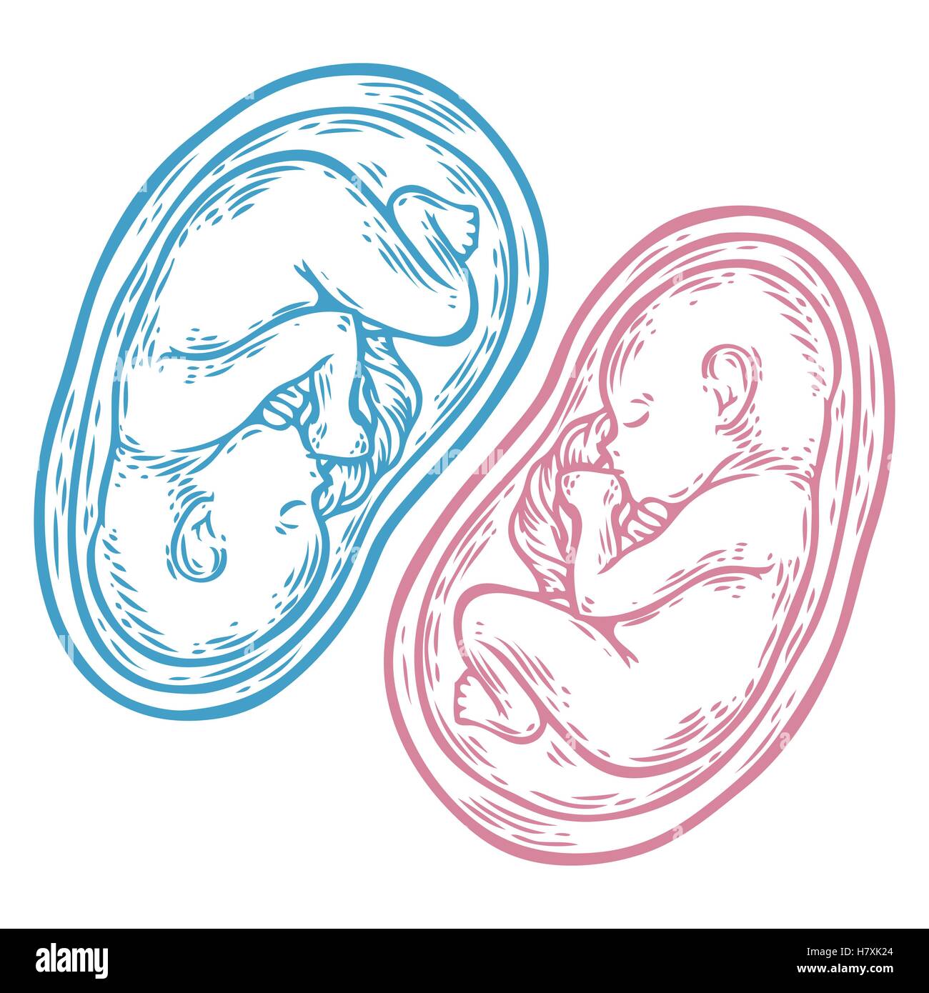 Human Embryo Twins