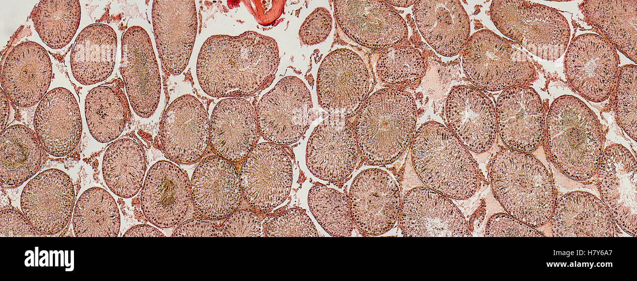 Peripheral Nerve Slide