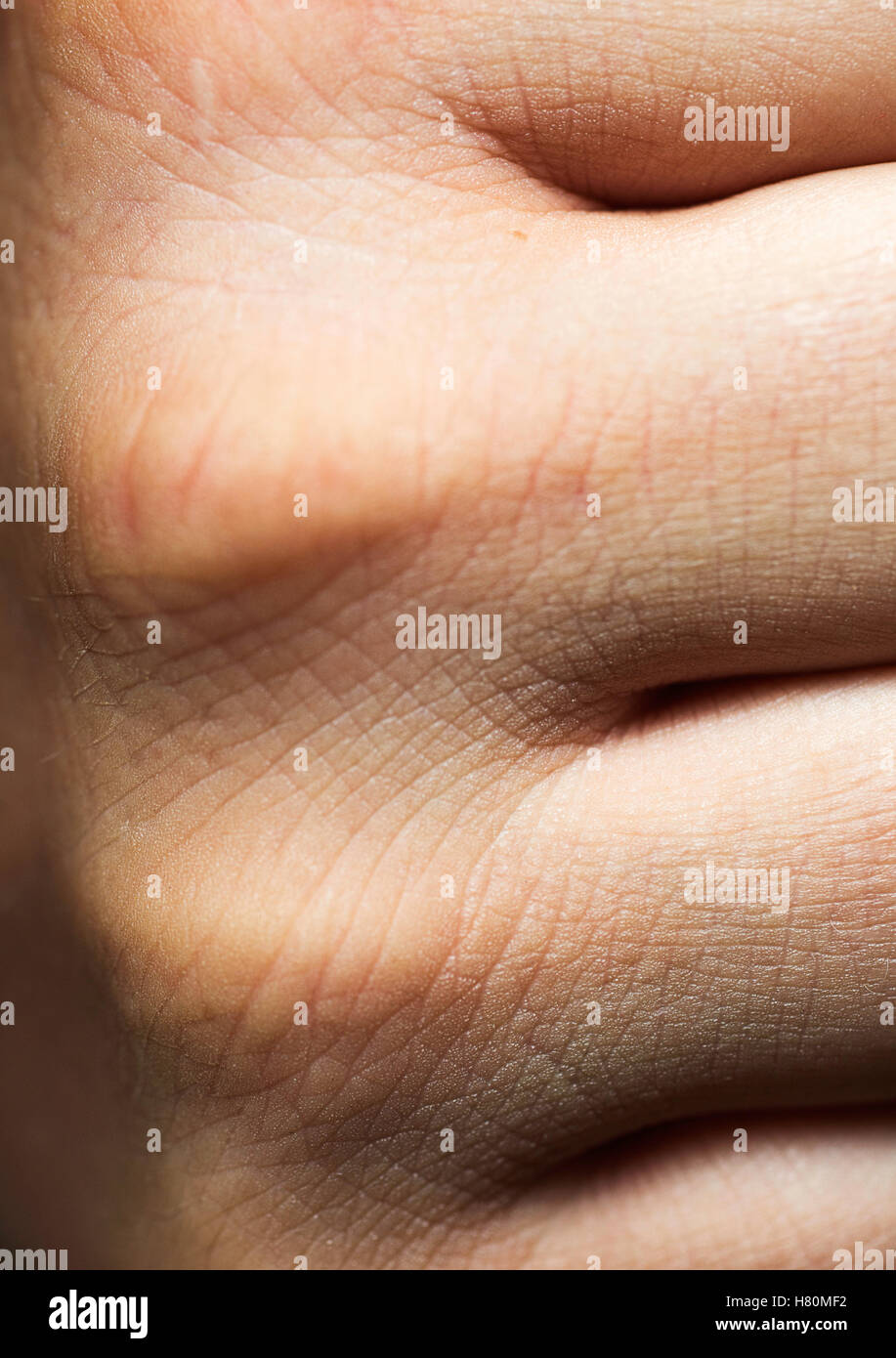 Hand knuckles hi-res stock photography and images - Alamy