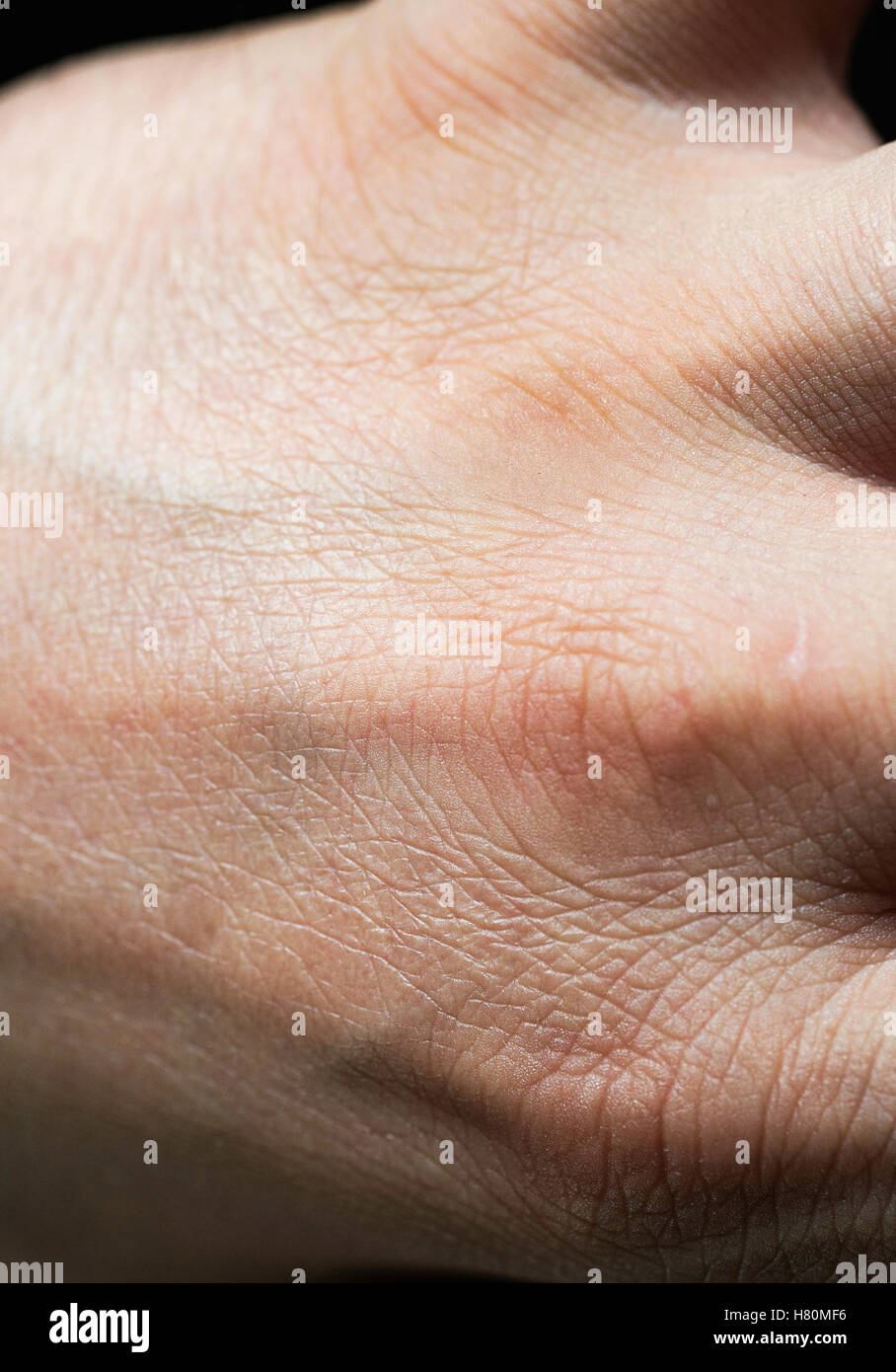 The skin on the back of a man's hand Stock Photo - Alamy