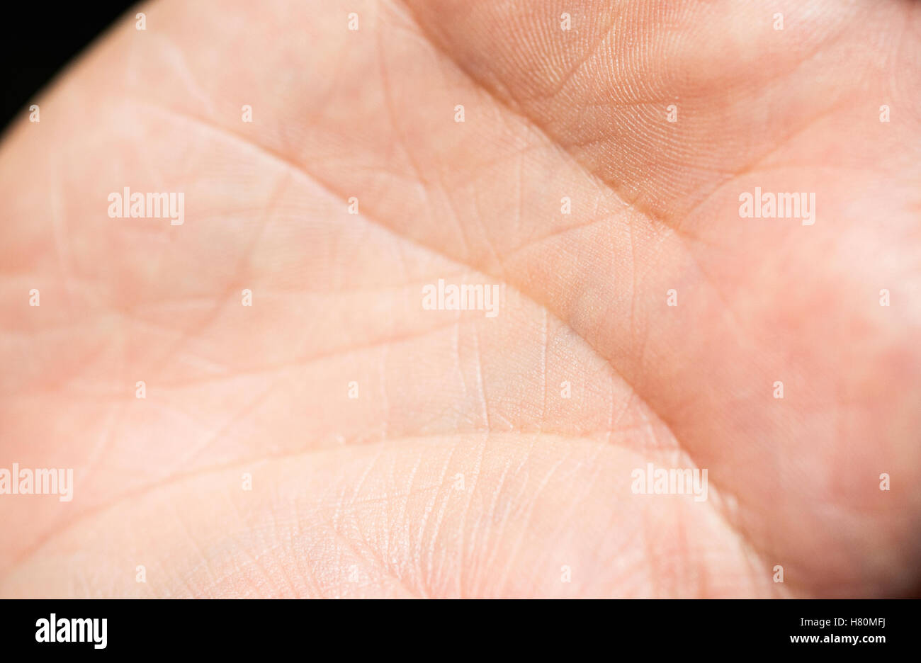 A close up of skin on the hand Stock Photo - Alamy