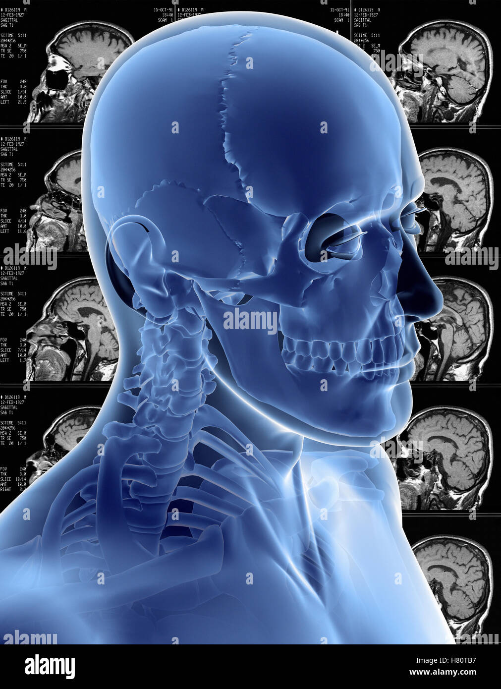 Cat brain anatomy hi-res stock photography and images - Alamy