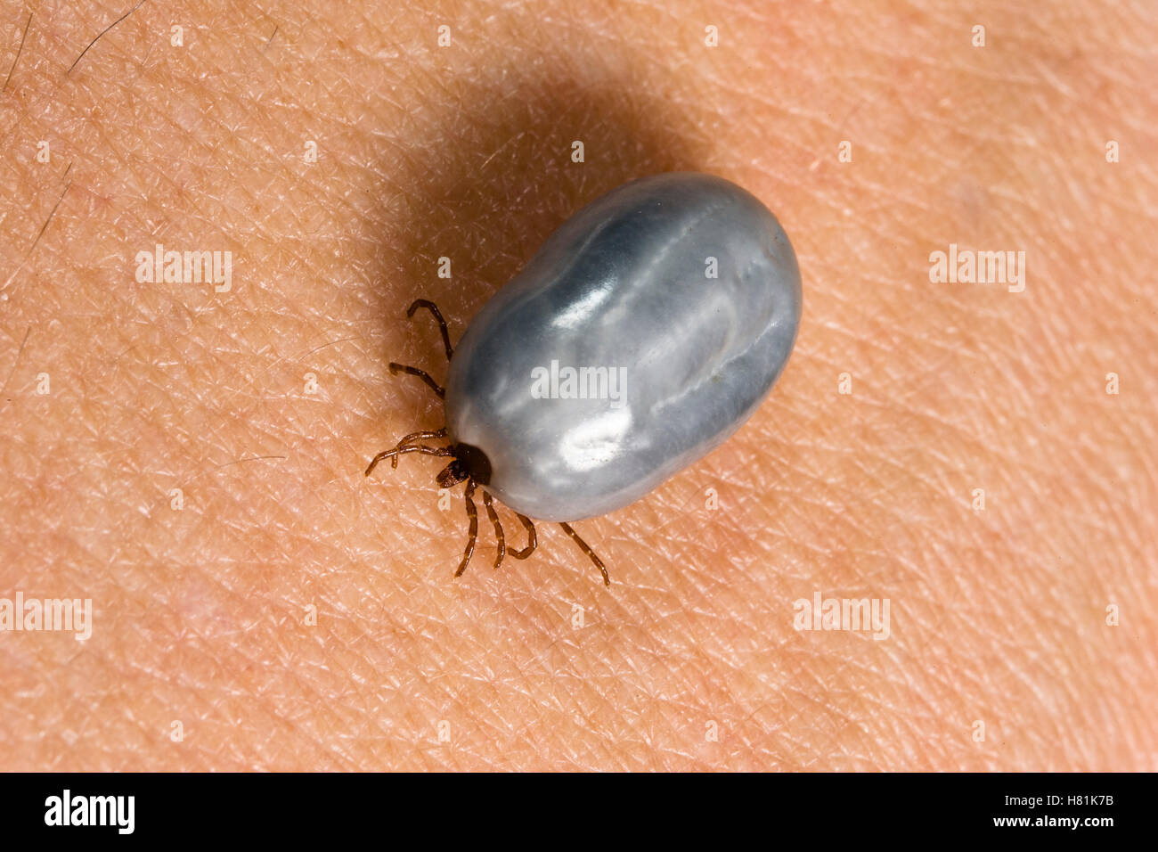 Sheep Tick (Ixodes ricinus) engorged with blood on skin, Bavaria ...