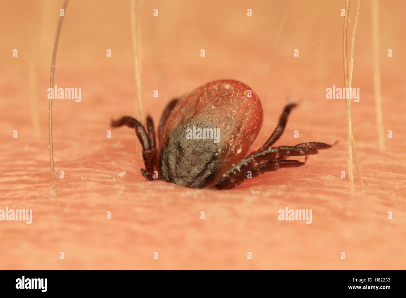 Sheep Tick (Ixodes ricinus) burrowed into human leg, Berkel en ...