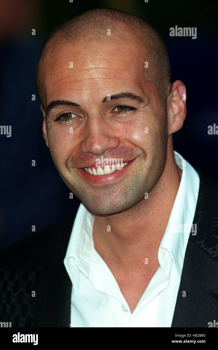 Billy Zane Hair Loss