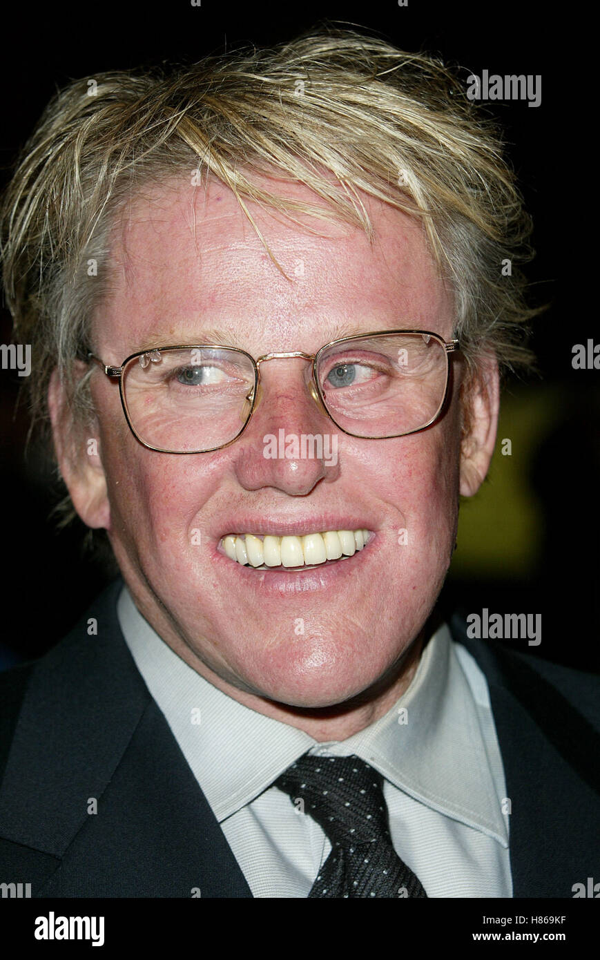 Gary Busey Teeth Before And After