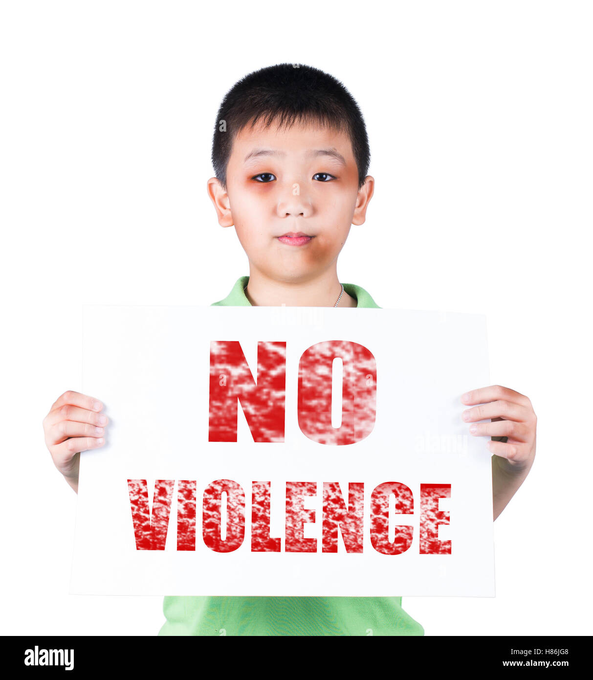 Asian abuse kid mistreatment with a black eye bruised and injured ...