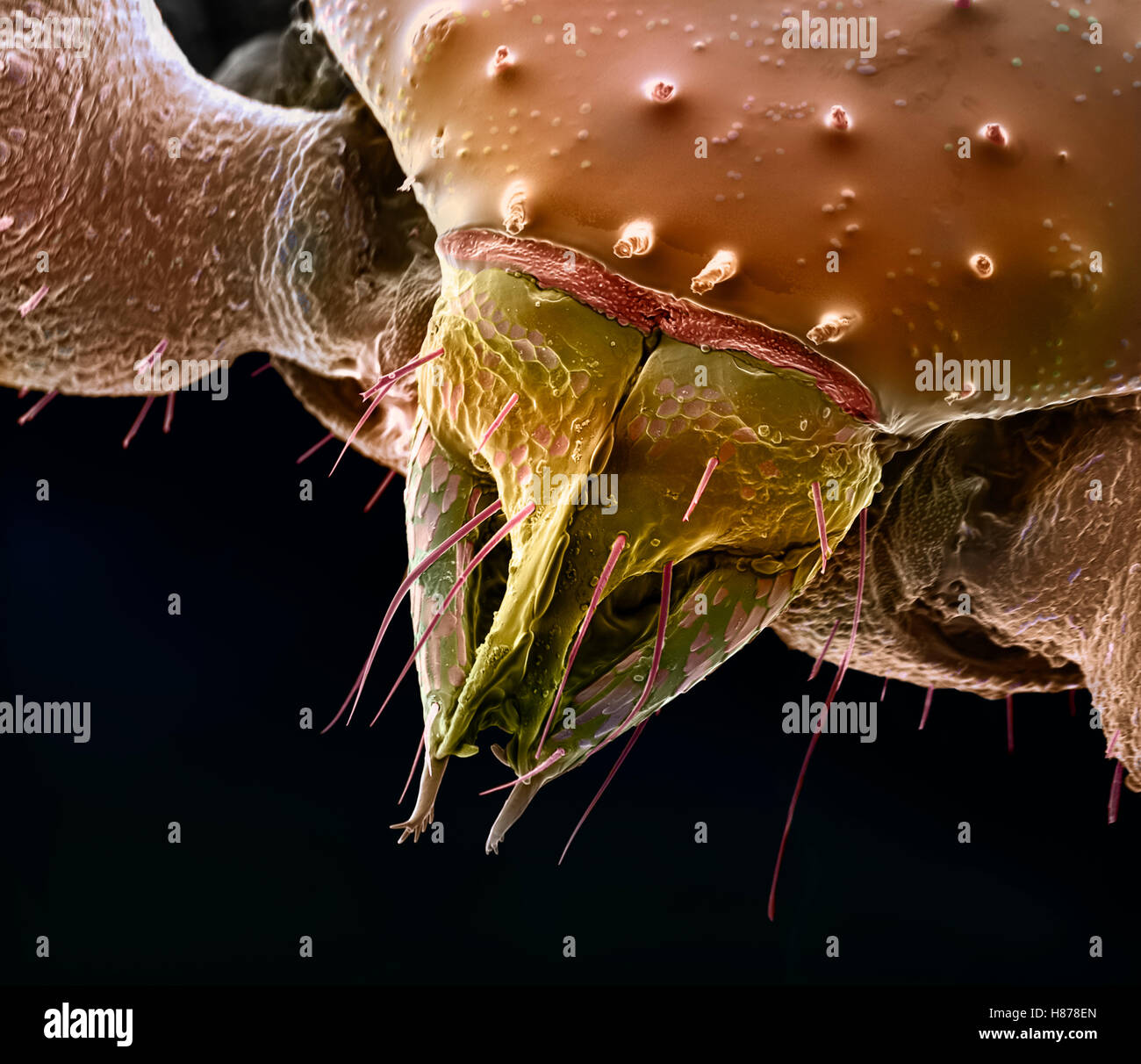 House Pseudoscorpion (Chelifer cancroides), magnified 500 times ...