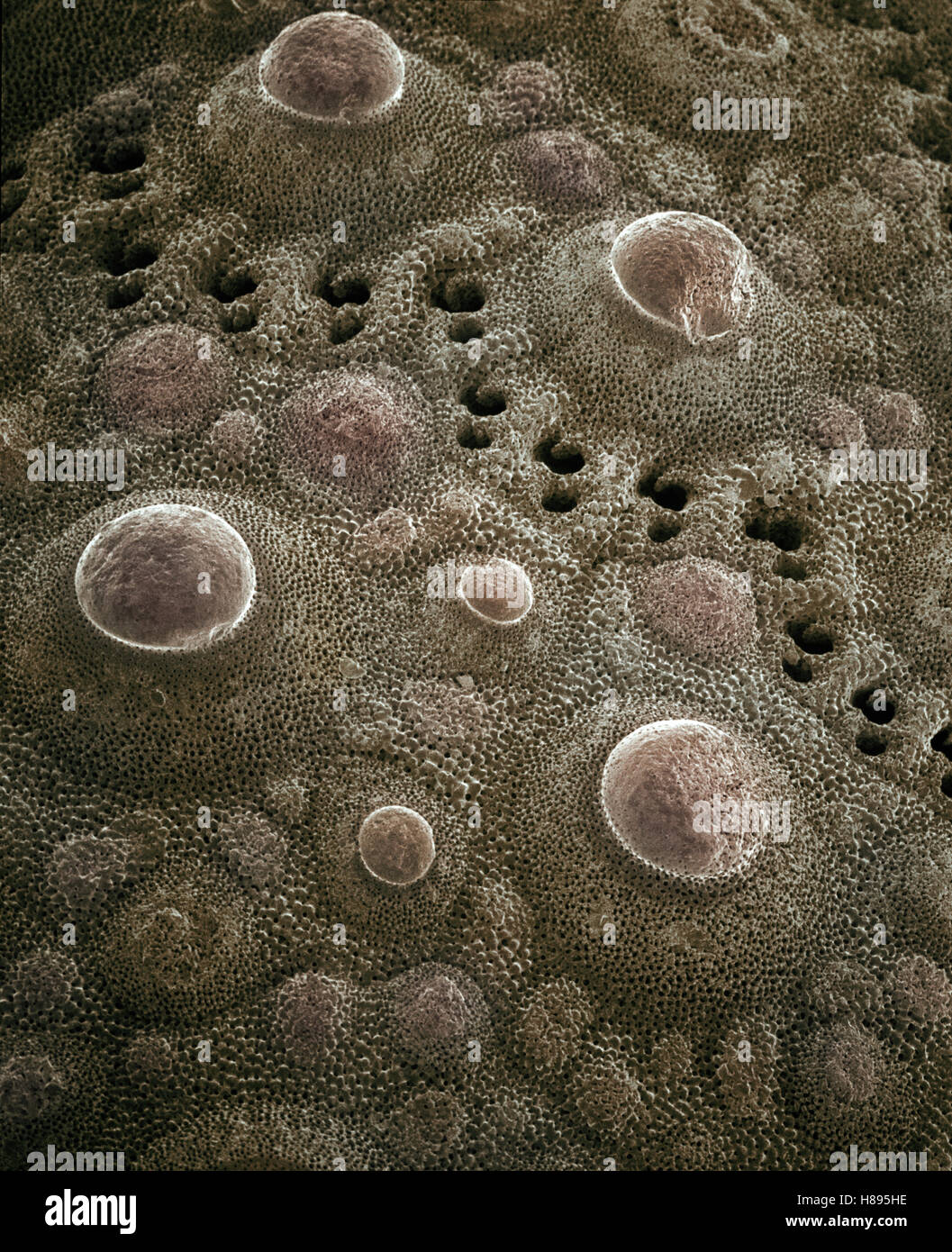Common Sea Urchin (Paracentrotus lividus) SEM close-up of the ...
