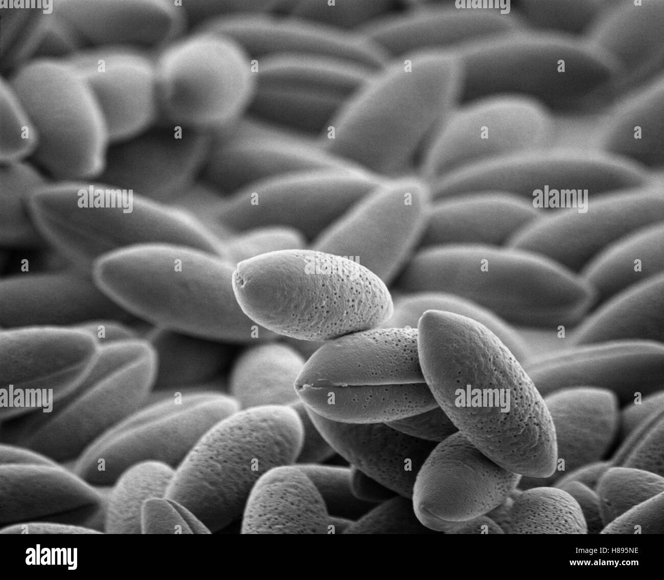Mediterranean Fan Palm (Chamaerops humilis) SEM close-up view of pollen ...